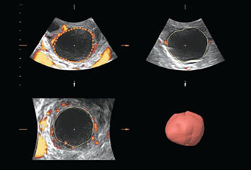 JaypeeDigital | eBook Reader