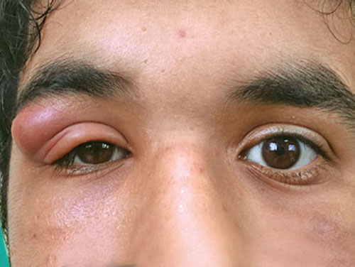 JaypeeDigital | eBook Reader