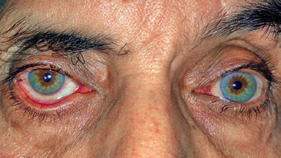 JaypeeDigital | eBook Reader